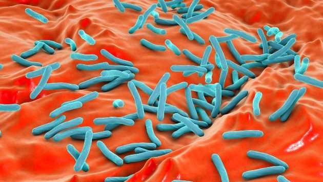 Kansas faces largest tuberculosis outbreak in US history: Health ...