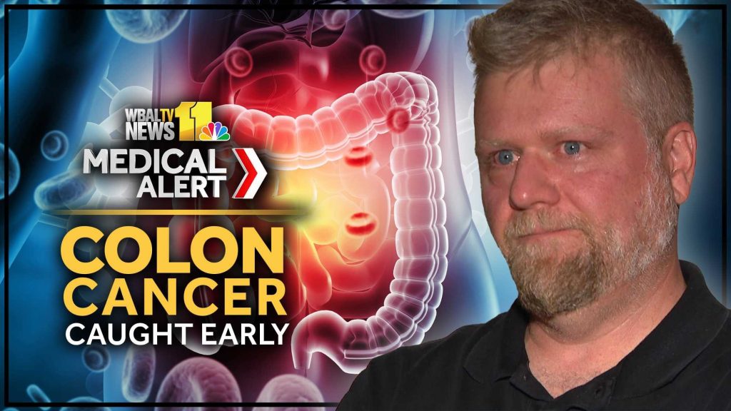 'What just happened?': Colon cancer caught early | Here's how | WBAL ...