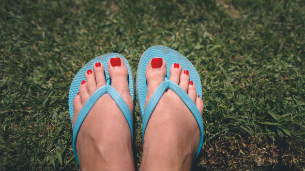 Flip-flops can increase injuries. Here's how to prevent summer foot ...