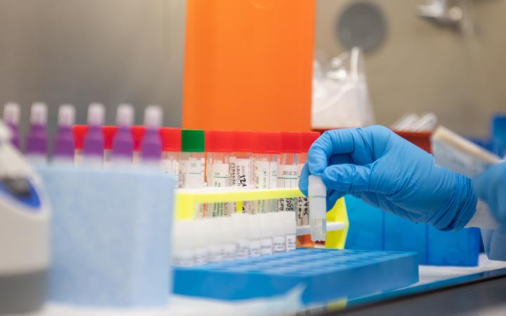 810 COVID-19 tests, all negative | Talanei